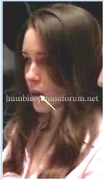 Casey Anthony tooth missing | The Published Pen